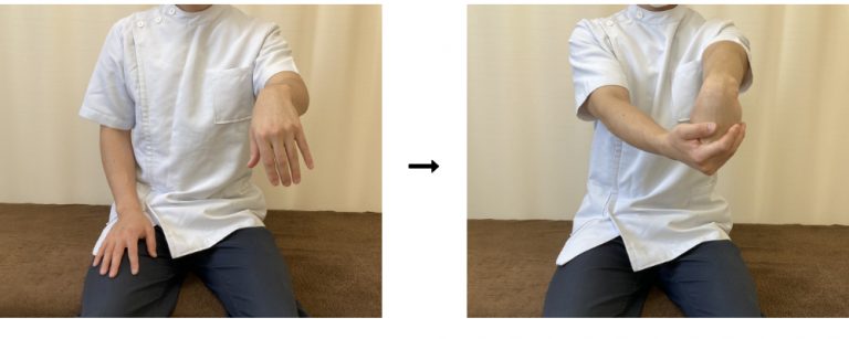 うでの痛み！【肘下の外側が辛い時】の自宅治療法とストレッチ 『レントゲン異常なし』と言われた後の体の痛みの治しかた