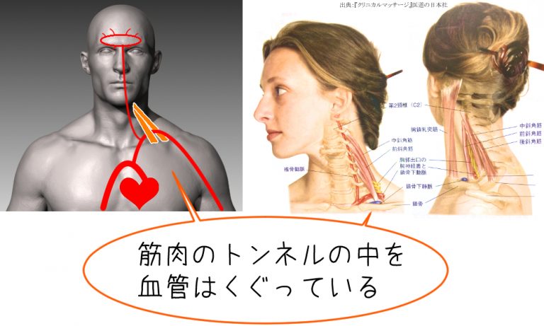 頭痛が続く!【頭のてっぺん】が痛い時の自宅での治し方薬以外の方法 『レントゲン異常なし』と言われた後の体の痛みの治しかた