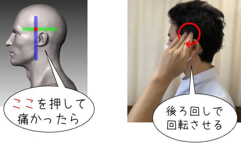 頭痛が続く！【頭の横】が痛い時の自宅での治し方片頭痛 『レントゲン異常なし』と言われた後の体の痛みの治しかた