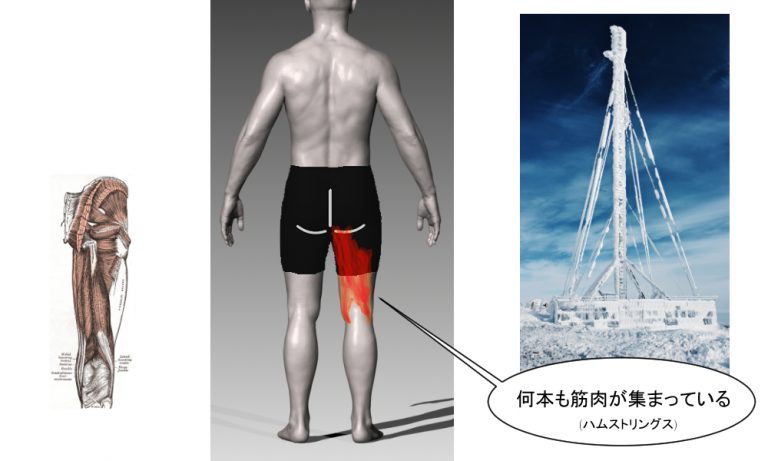 【太もも裏の筋肉】が痛い・だるい・つる時の一番良いマッサージ法 『レントゲン異常なし』と言われた後の体の痛みの治しかた