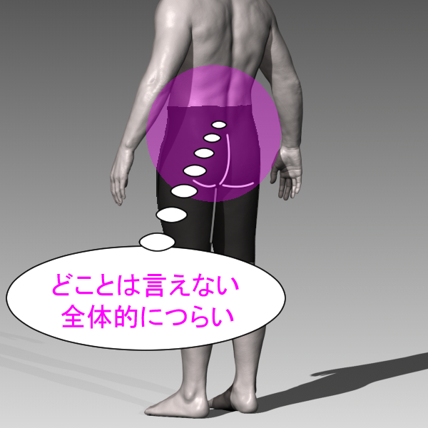 腰が痛い！【腰全体の痛み】の自宅治療法とストレッチ 『レントゲン異常なし』と言われた後の体の痛みの治しかた