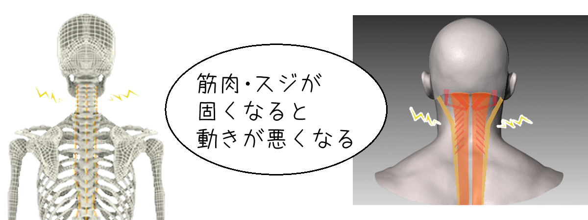 首こり解消!【横を向くと首がつらい時】の原因と自宅での治療法 『レントゲン異常なし』と言われた後の体の痛みの治しかた